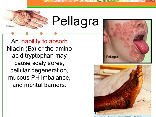Fn1 ppt. vitamins and minerals