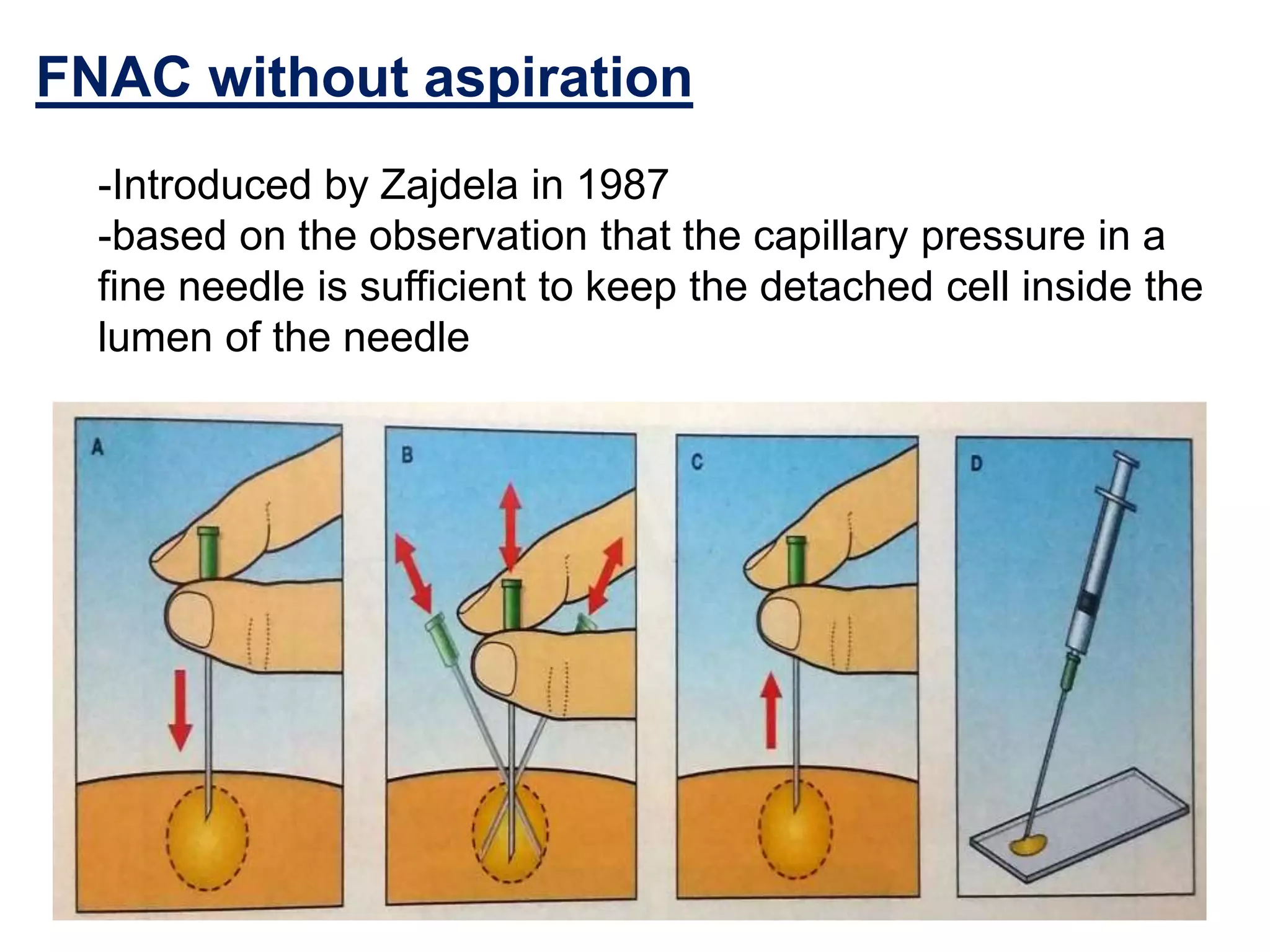 FINE NEEDLE ASPIRATION CYTOLOGY / FNAC | PPTX