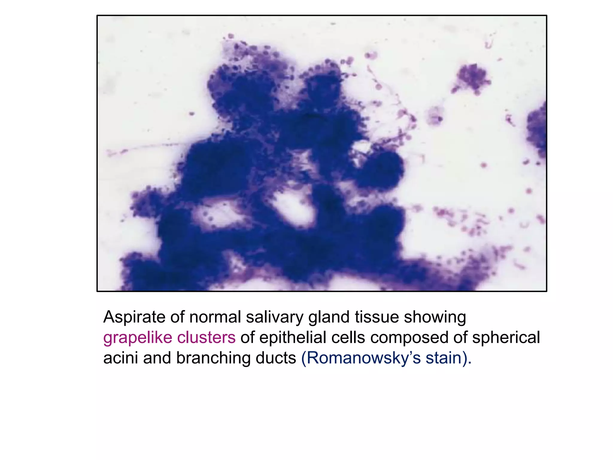 FINE NEEDLE ASPIRATION CYTOLOGY / FNAC | PPTX