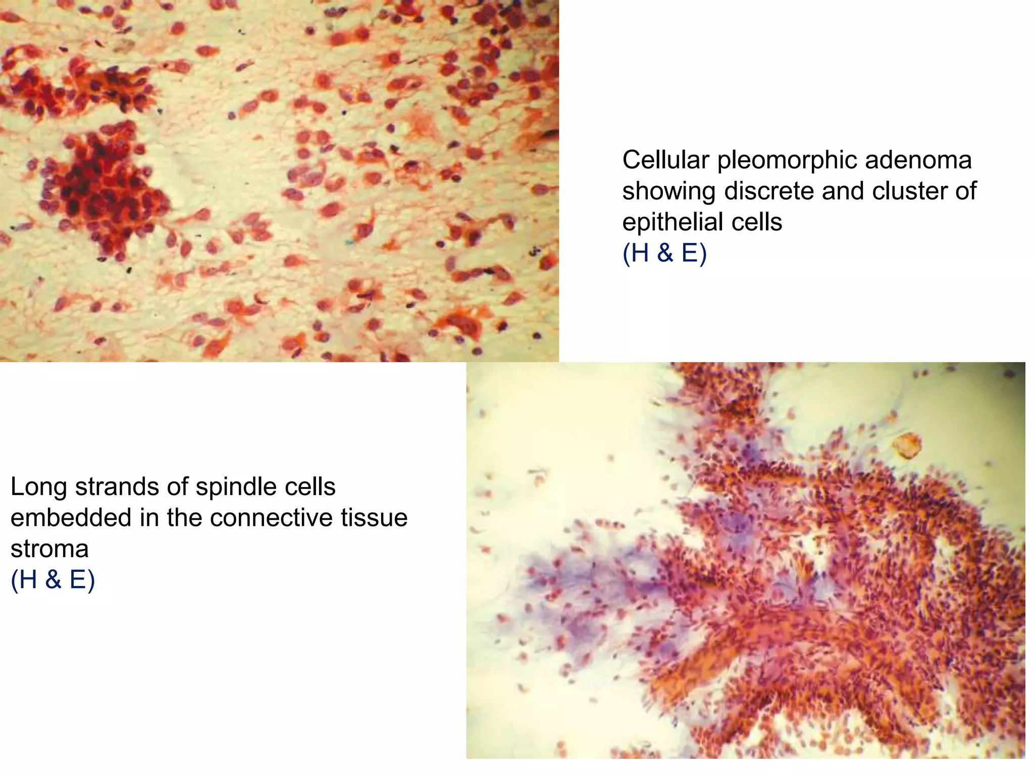 FINE NEEDLE ASPIRATION CYTOLOGY / FNAC | PPTX