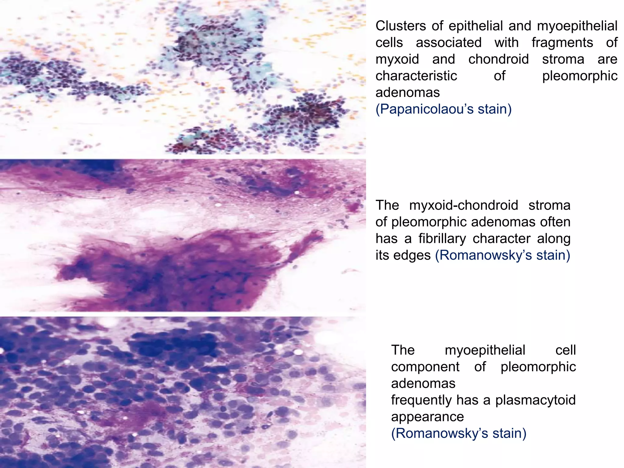FINE NEEDLE ASPIRATION CYTOLOGY / FNAC | PPTX