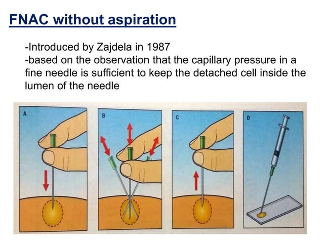 FINE NEEDLE ASPIRATION CYTOLOGY / FNAC | PPTX