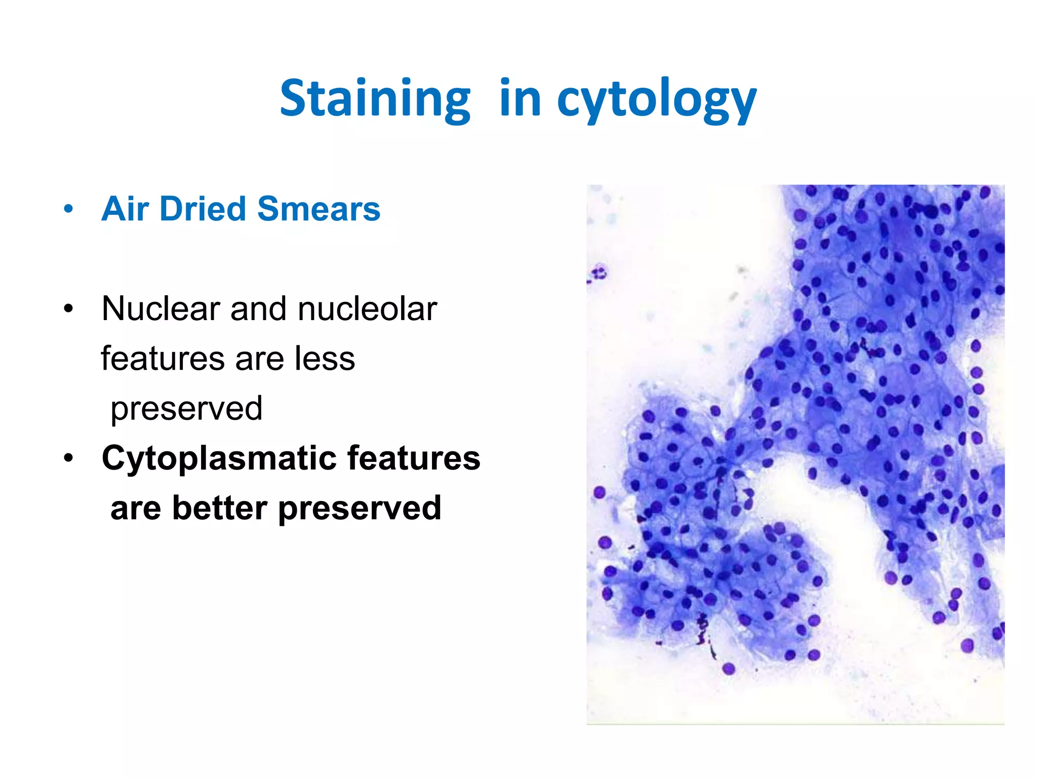Fine needle aspiration cytology | PPTX