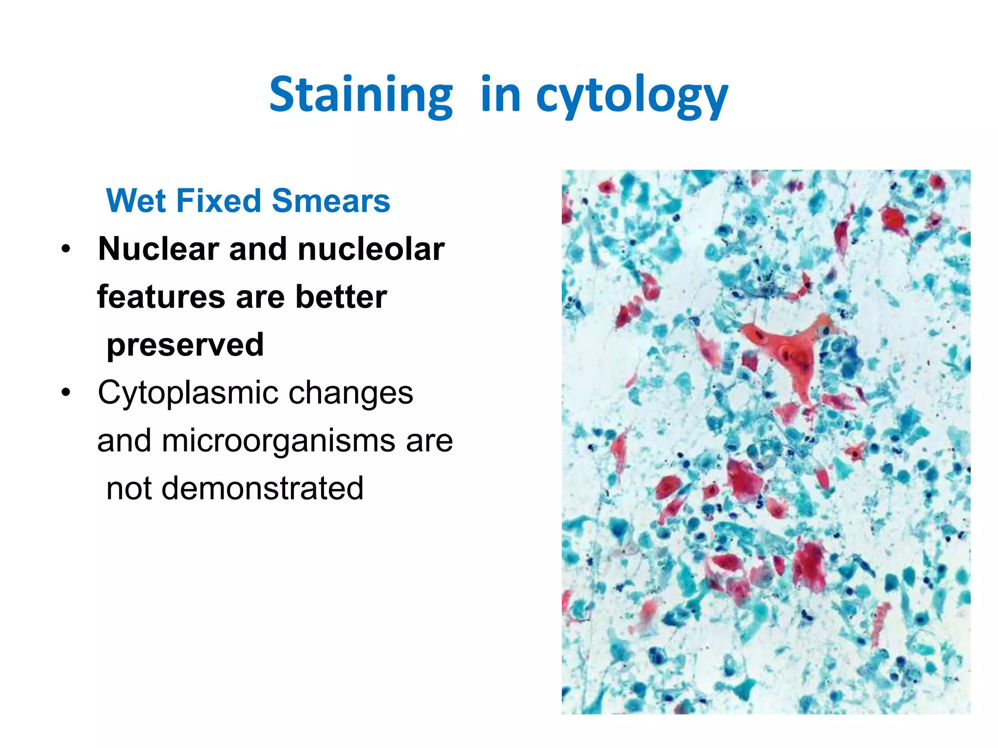 Fine needle aspiration cytology | PPTX