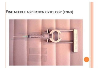 Fine needle aspiration cytology | PPTX