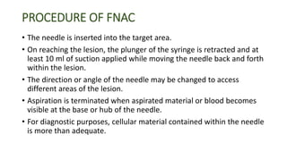 Fine needle aspiration cytology procedure | PPTX