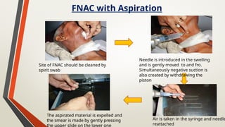 FNAC_DIRECT_and_GUIDED Pathology [1]_FINAL2.pptx