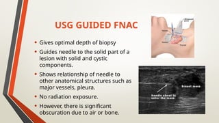 FNAC_DIRECT_and_GUIDED Pathology [1]_FINAL2.pptx