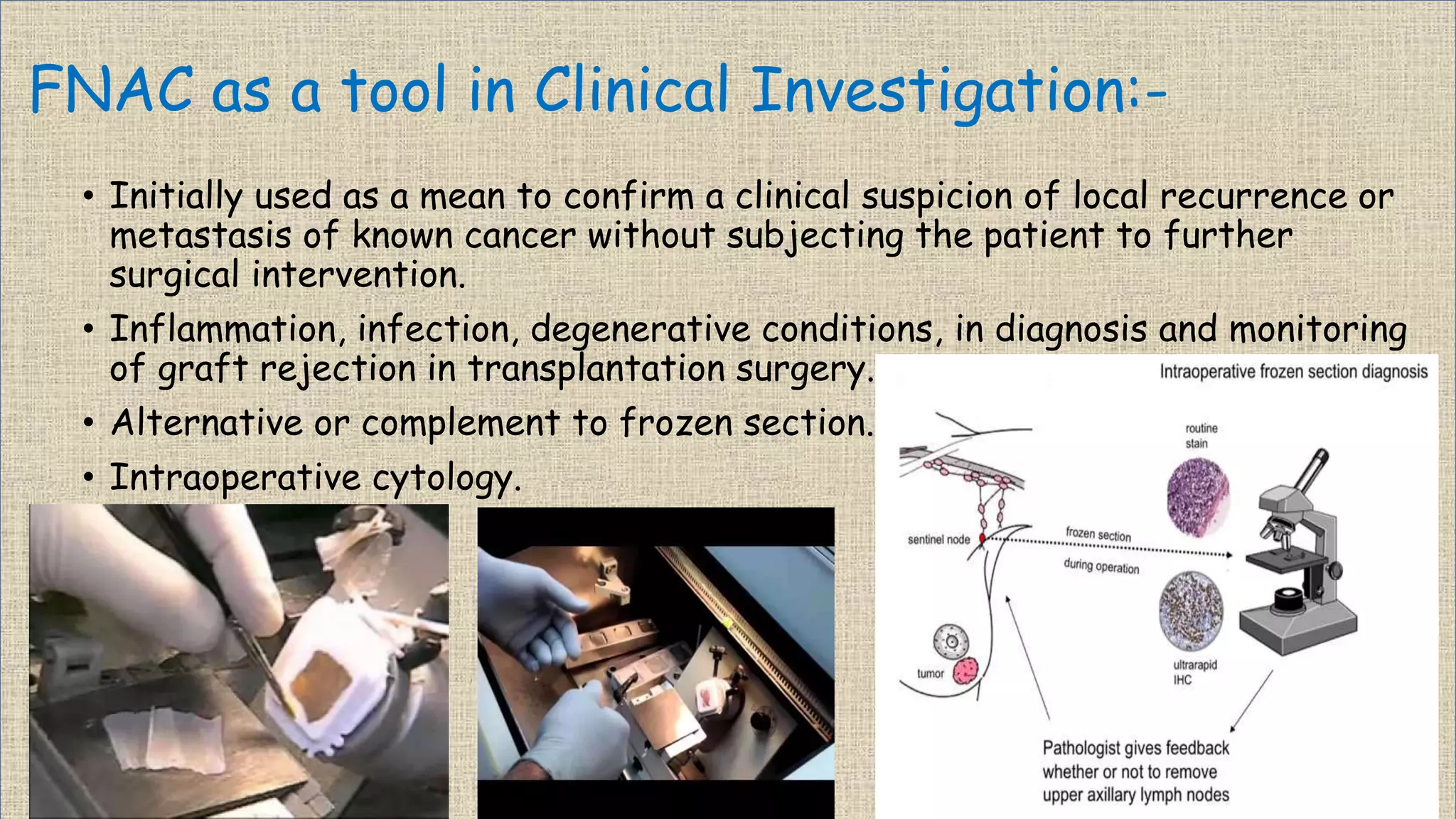 Fine Needle Aspiration Cytology (FNAC) | PPTX