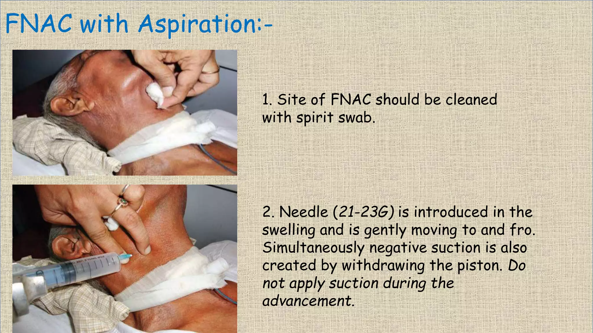 Fine Needle Aspiration Cytology (FNAC) | PPTX