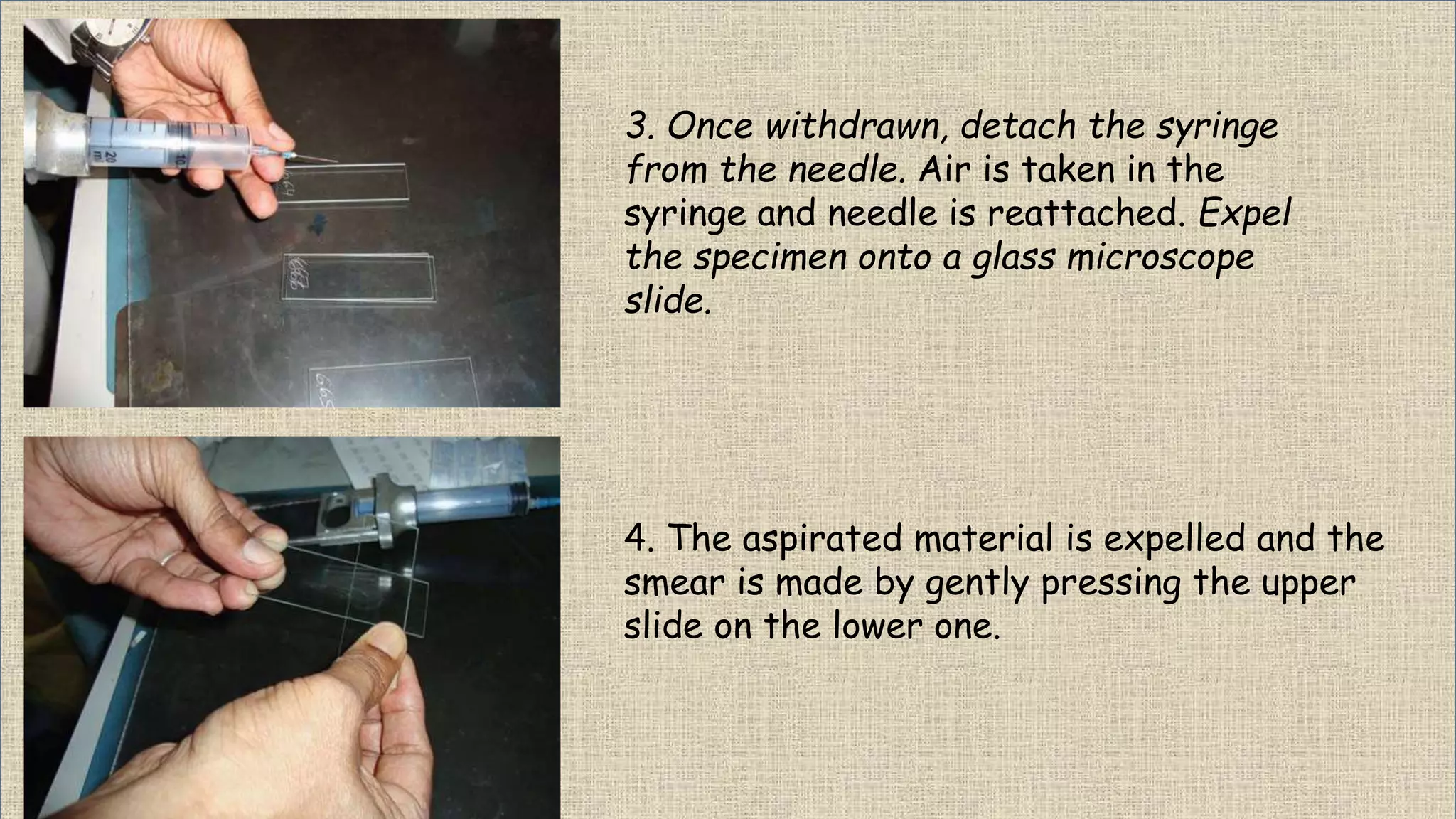Fine Needle Aspiration Cytology (FNAC) | PPTX