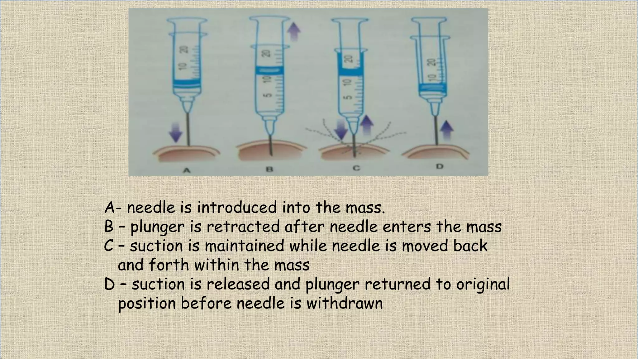 Fine Needle Aspiration Cytology (FNAC) | PPTX
