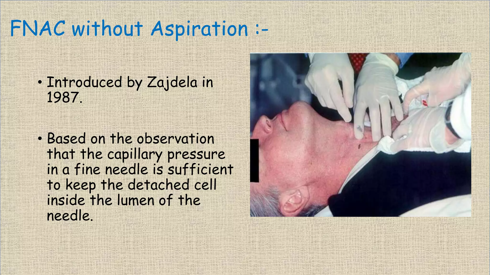 Fine Needle Aspiration Cytology (FNAC) | PPTX