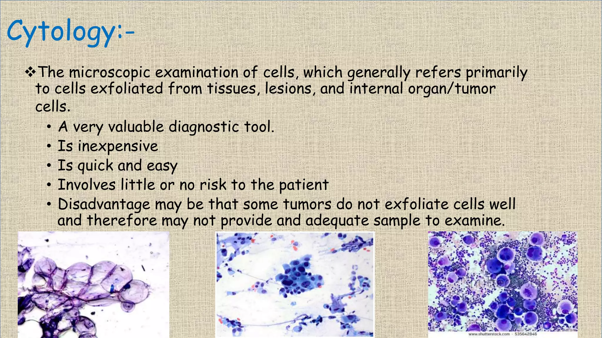 Fine Needle Aspiration Cytology (FNAC) | PPTX