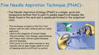 Fine Needle Aspiration Cytology (FNAC) | PPTX