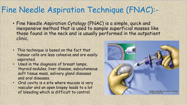 Fine Needle Aspiration Cytology (FNAC) | PPTX | Dental Health ...