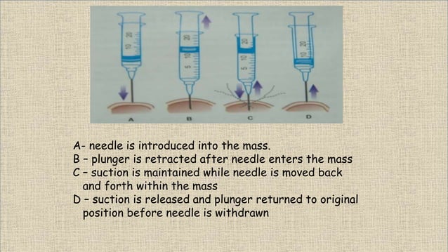 Fine Needle Aspiration Cytology (FNAC) | PPTX | Dental Health ...