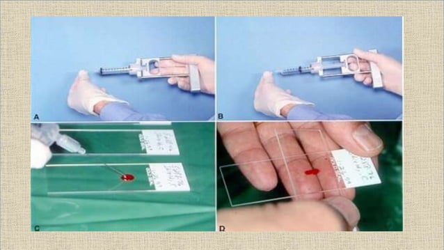 Fine Needle Aspiration Cytology (FNAC) | PPTX | Dental Health ...