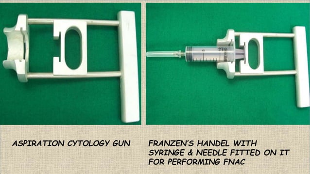 Fine Needle Aspiration Cytology (FNAC) | PPTX | Dental Health ...