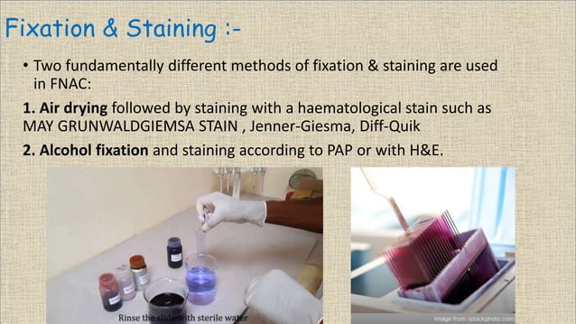 Fine Needle Aspiration Cytology (FNAC) | PPTX | Dental Health ...