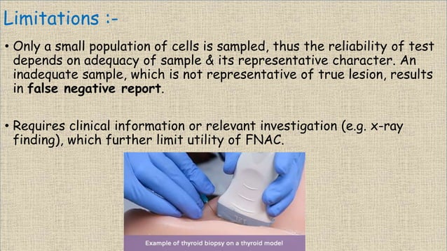 Fine Needle Aspiration Cytology (FNAC) | PPTX | Dental Health ...