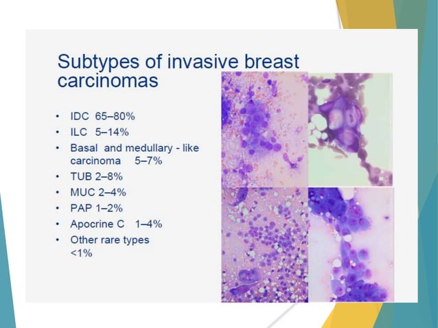 Fnac of breast | PPTX | Skin Care | Beauty