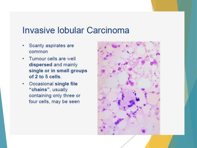 Fnac of breast | PPTX | Skin Care | Beauty