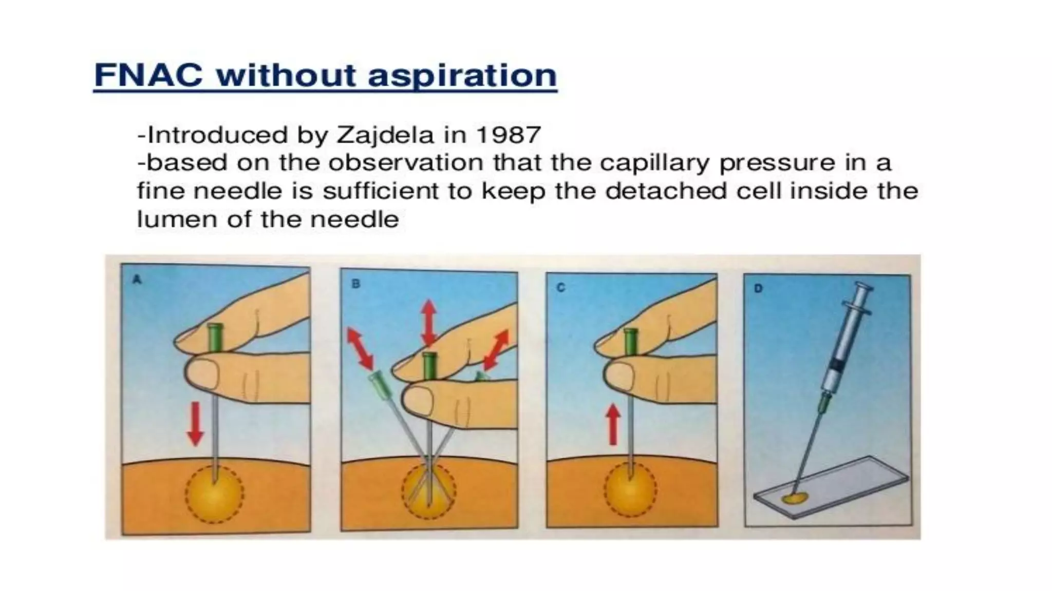 FNAC fine needle aspiration cytology | PDF
