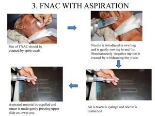 FNAC SEMINAR.pptx fine needle aspiration | PPTX