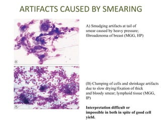 FNAC SEMINAR.pptx fine needle aspiration | PPTX