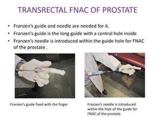 FNAC SEMINAR.pptx fine needle aspiration | PPTX