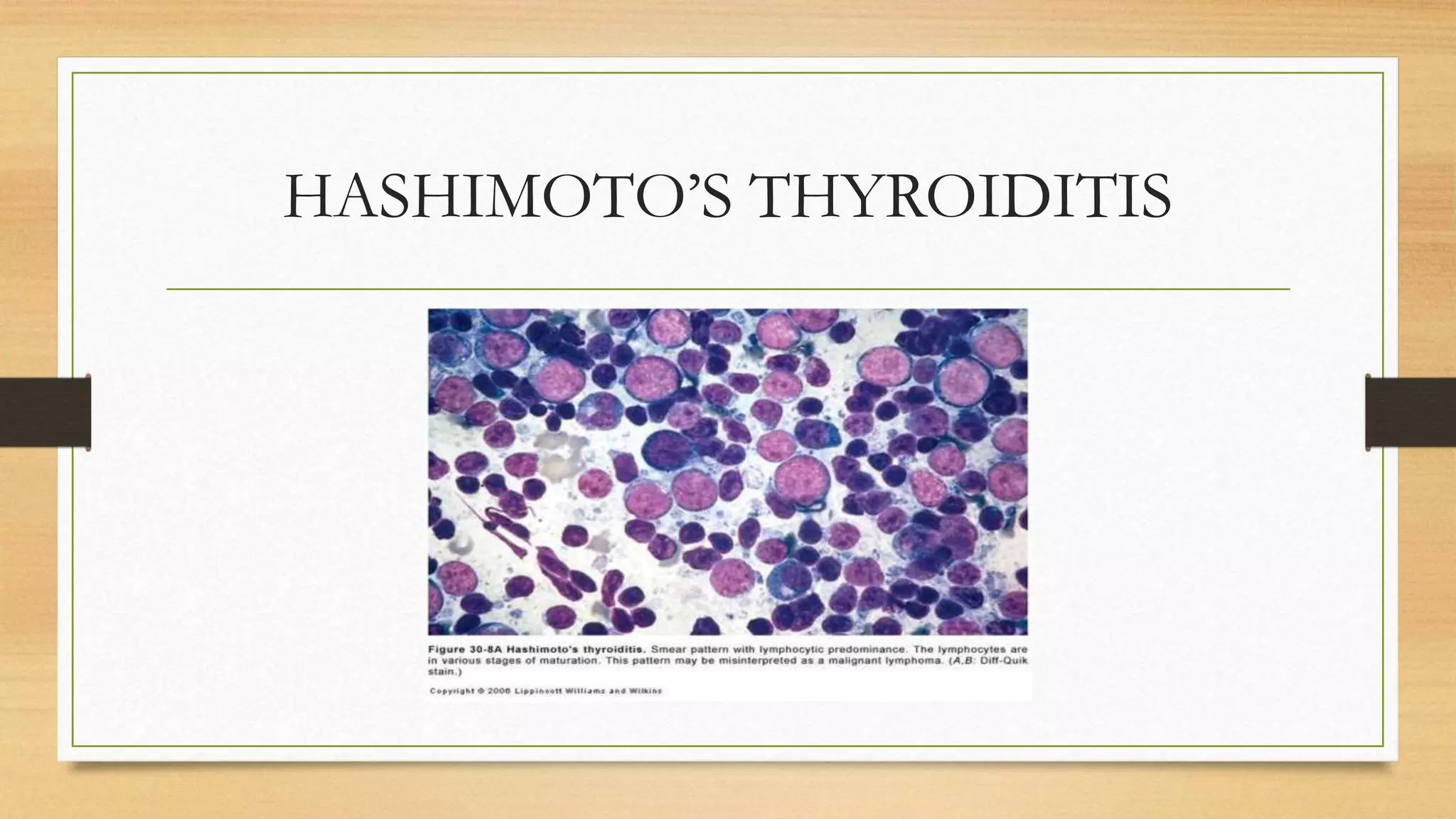 Fnac thyroid | PPTX