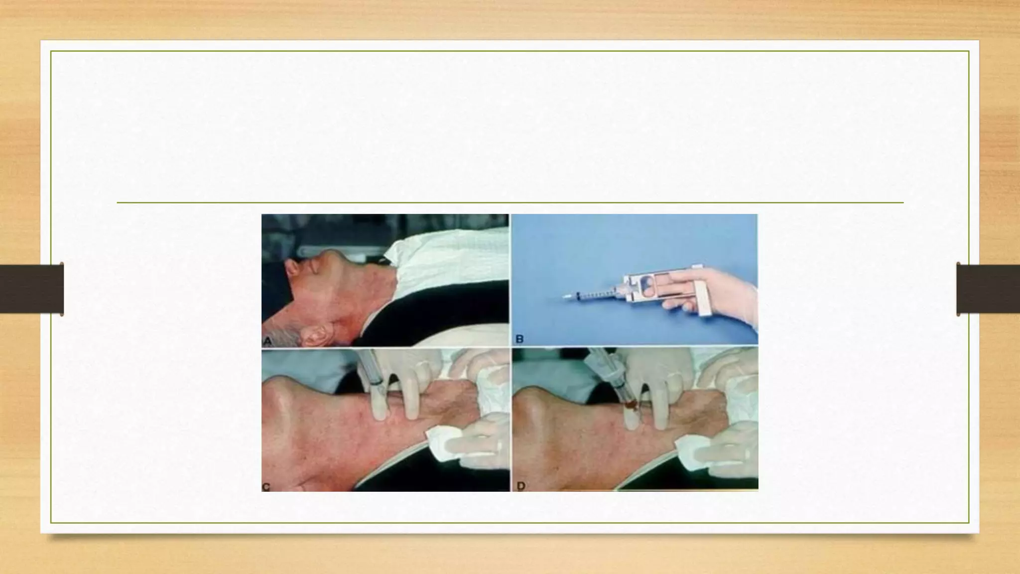 Fnac thyroid | PPTX