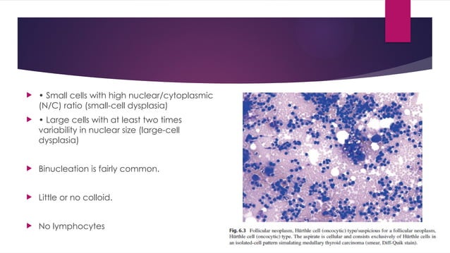 FNAC thyroid Bethesda system GARGI .pptx