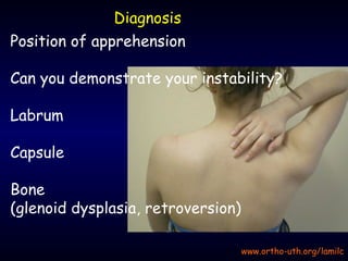 Posterior instability | PPT