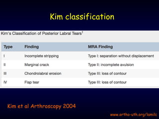 Posterior instability | PPT