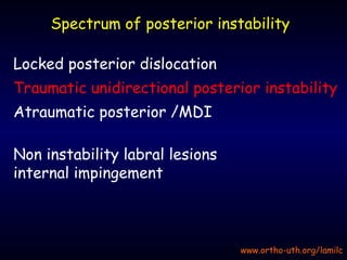 Posterior instability | PPT