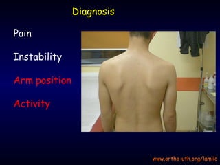 Posterior instability | PPT