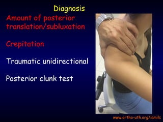 Posterior instability | PPT