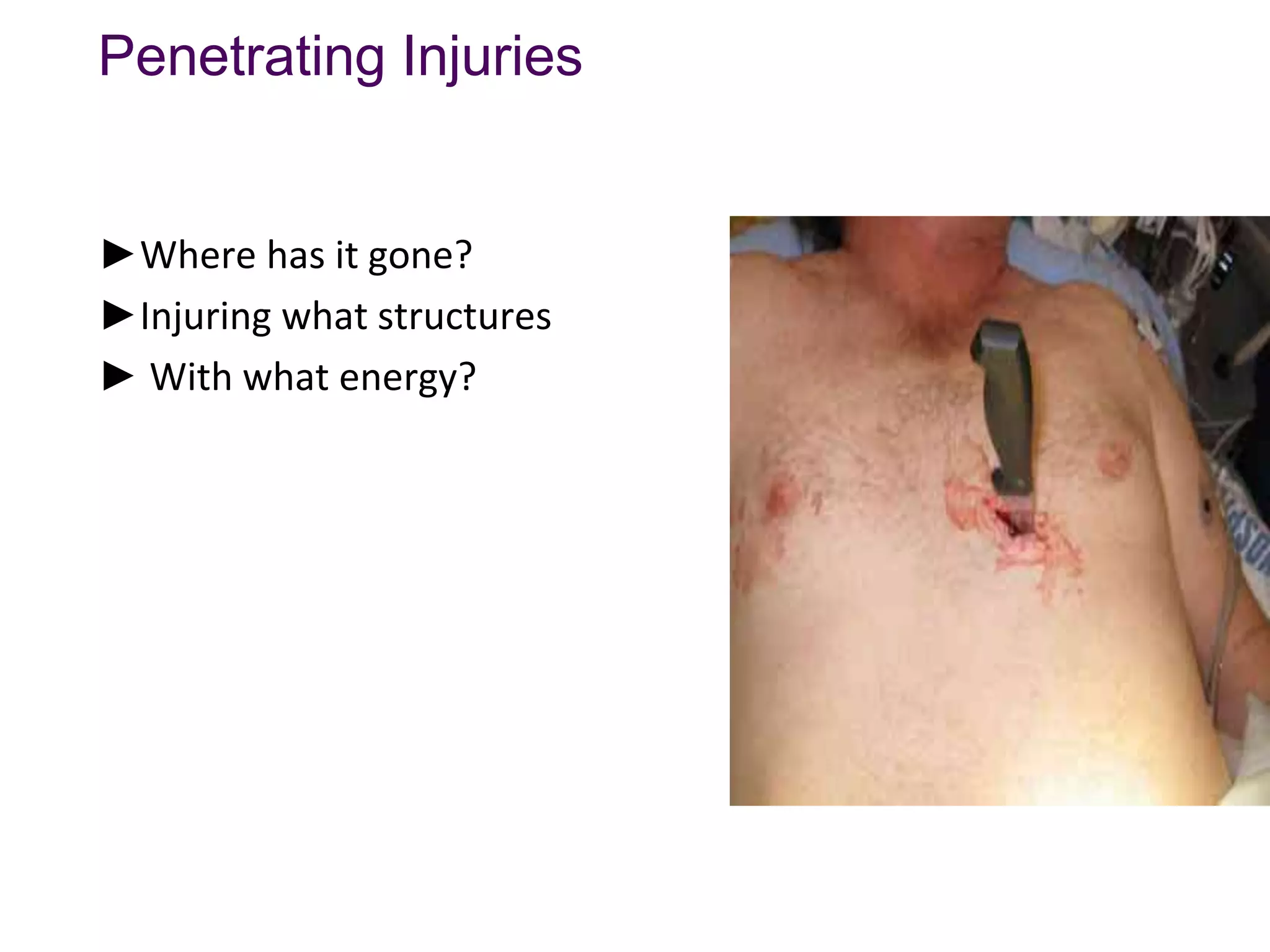 Penetrating injuries by Professor Mark Midwinter | PPT