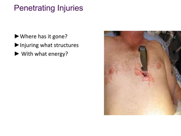 Penetrating injuries by Professor Mark Midwinter | PPTX