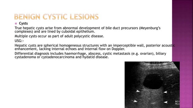 Focal and diffuse lesions of liver | PPTX