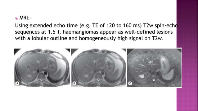 Focal and diffuse lesions of liver | PPTX