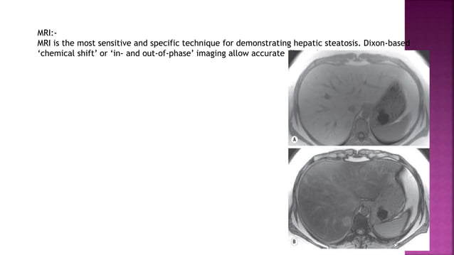 Focal and diffuse lesions of liver | PPTX
