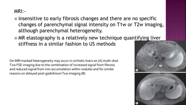 Focal and diffuse lesions of liver | PPTX