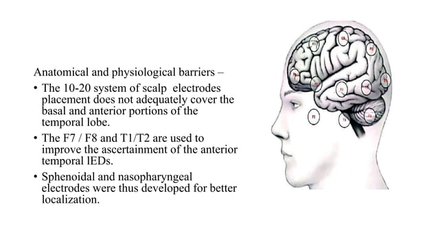 Focal epileptiform patterns principles of polarity | PPT