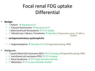 Focal renal fdg uptake | PPT