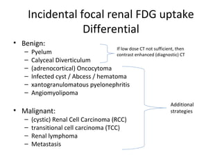 Focal renal fdg uptake | PPT