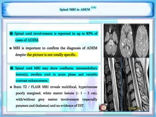 Tips, Pearls and Pitfalls of Spinal Cord MRI | PPTX