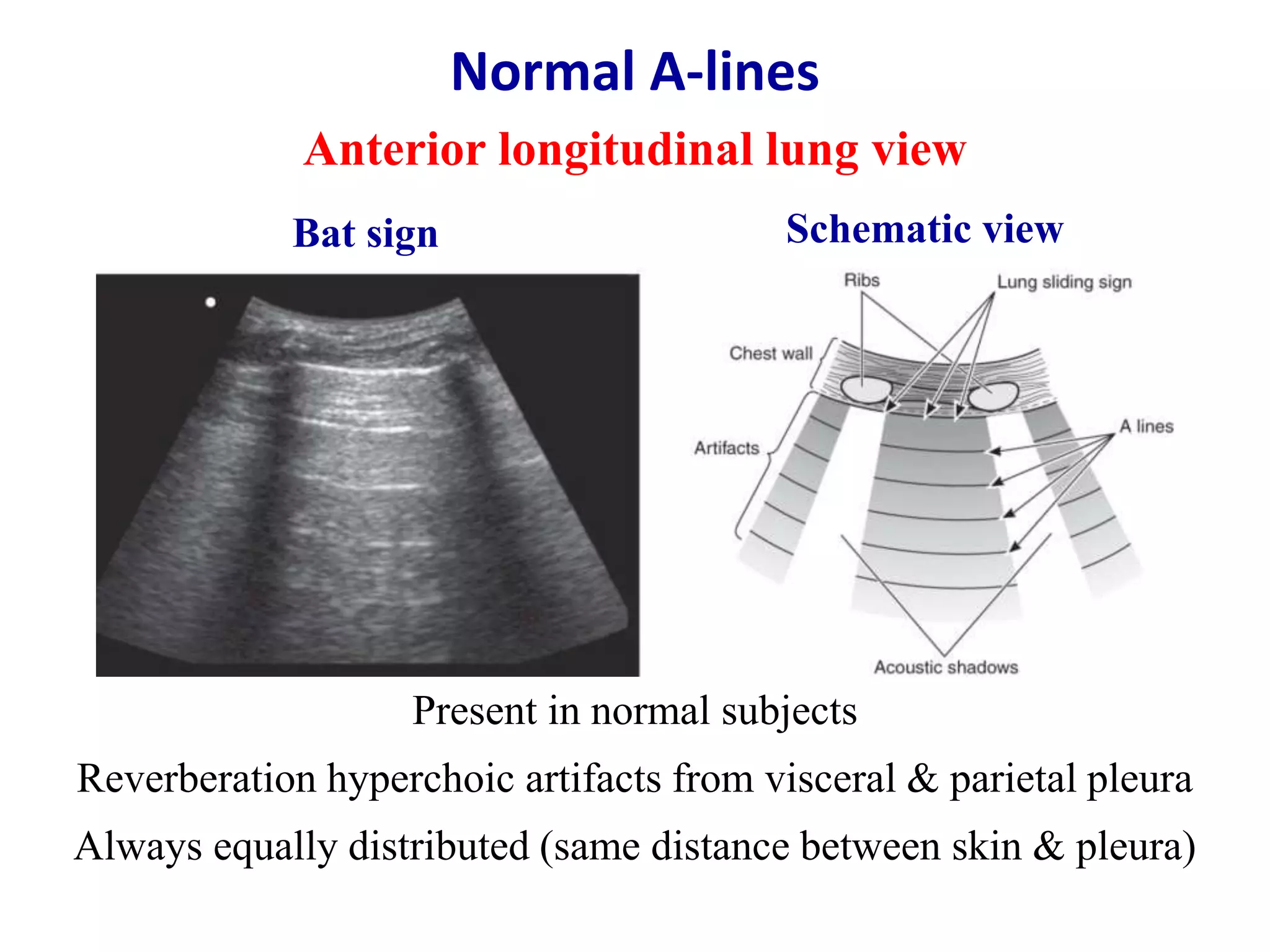 Extended focus assessment with sonography for trauma | PPTX